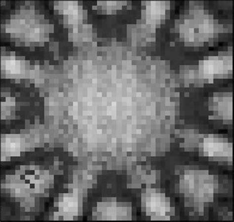 Image result for EPB Ultrasound Linear Array