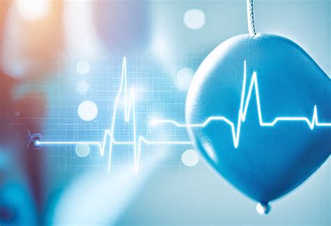 Image result for Recovery After Pacemaker Surgery