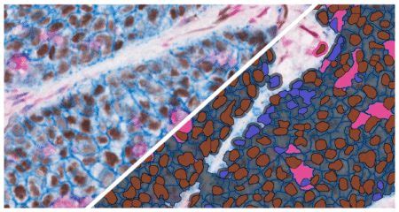 Image result for Multiplex IHC