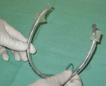 Image result for Digital Intubation