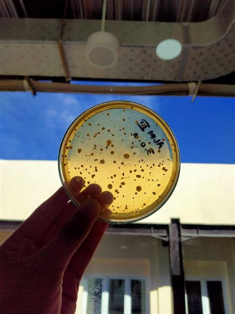 Image result for Total Count Method Microbiology