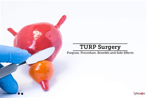 Image result for Prostate Operation Procedure