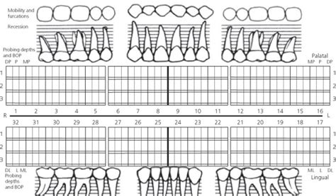 Image result for How to Read a Perio Chart