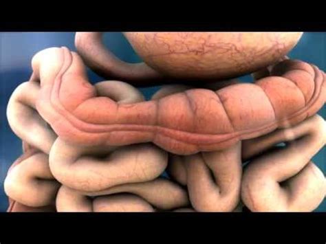 Image result for Straining Bowel Animation