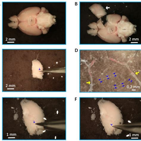 Image result for Mouse Brain Dissection