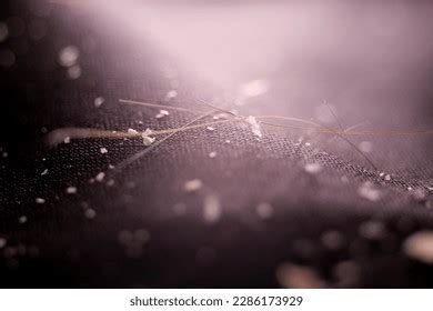 Image result for Seborrheic Dermatitis Contagious