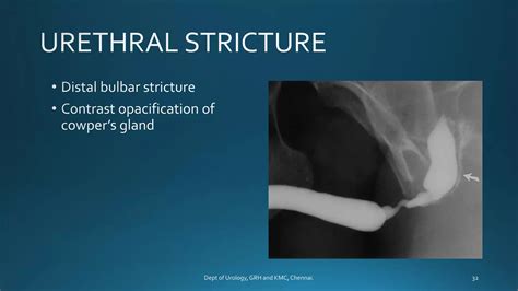 Image result for Acending Urethrogram
