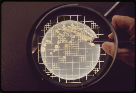 Image result for Microscopic Count