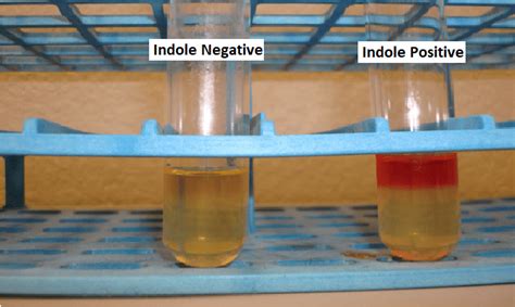 Image result for Indole Test Procedure
