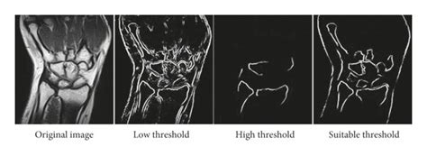 Image result for Canny Edge Extraction MATLAB