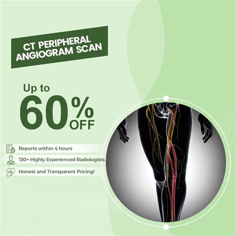 Image result for Peripheral Angiogram