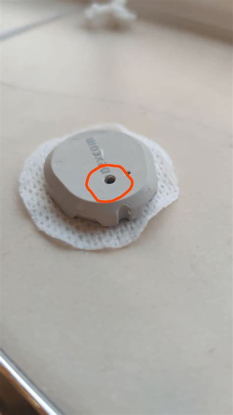 Image result for Dexcom Sensor Filament Structure