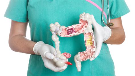 Image result for Colon Open Cancer Removal