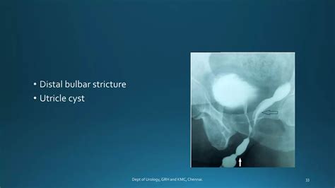 Image result for Acending Urethrogram