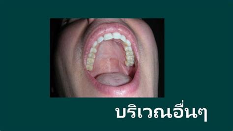 Image result for Normal Variation Genetics