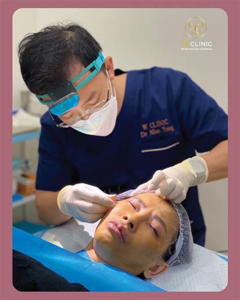 Image result for Thread Lifting Face