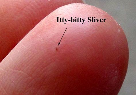 Image result for Small Splinter