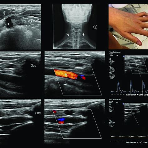 Image result for TOS Voltility Scan