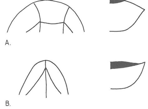 Image result for Distal Control Elements