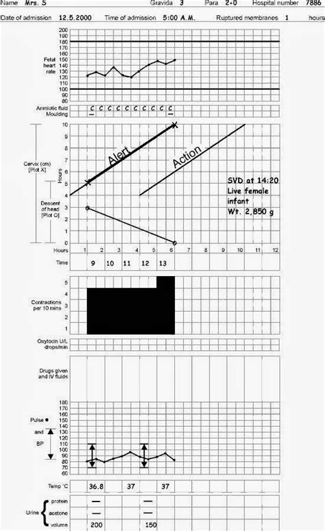 Image result for Normal Partograph