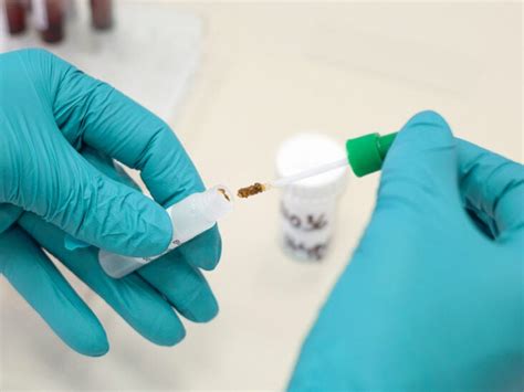 Image result for Stool Sample Test