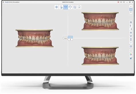 Image result for Medit Software