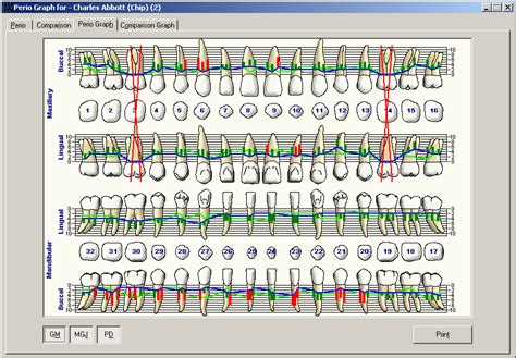 Image result for How to Read a Perio Chart