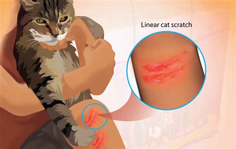 Image result for Cat Scratch Fever Tutorial