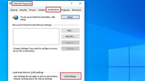 Image result for DHCP Is Not Enabled for Local Area Connection