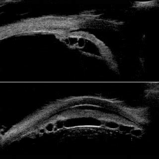 Image result for Scanned Linear Array