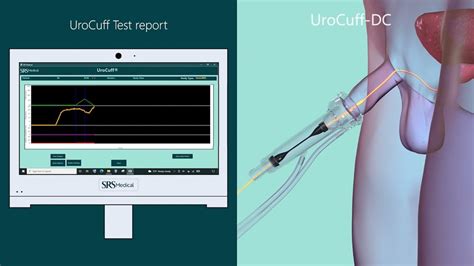Image result for How Does a Urocuff Work