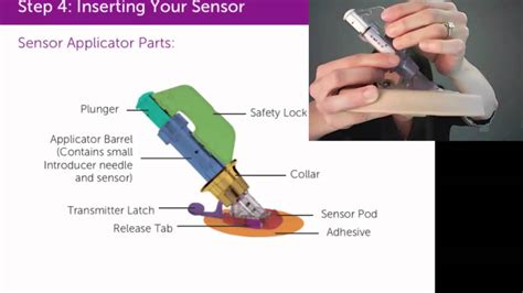 Image result for Dexcom Sensor Filament Structure