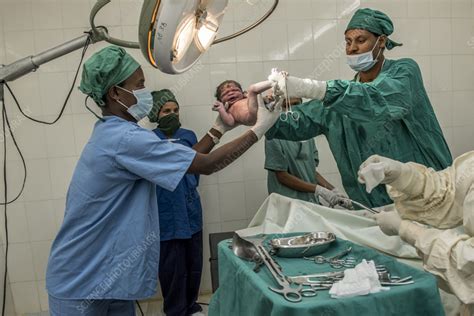 Image result for Childbirth Explained