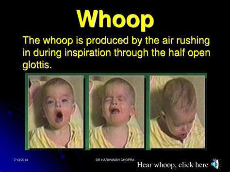 Image result for But Whooping