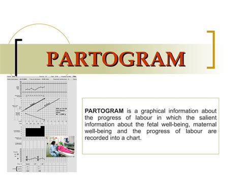 Image result for Partogram Design