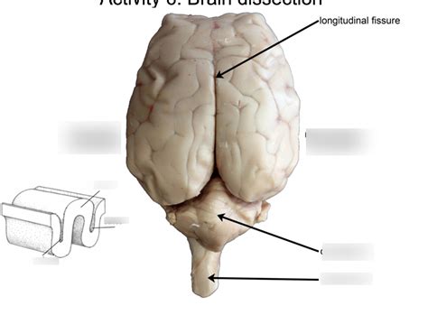 Image result for Brain Dissection