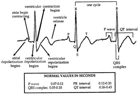 Pr Interval Normal Range - CallumgroBerger