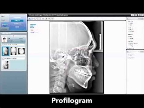 Image result for OrthoVision Dat Testing