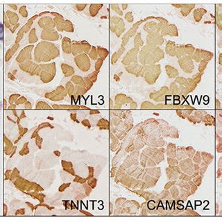 Image result for Tissue Microarray Multiplex IHC NCR