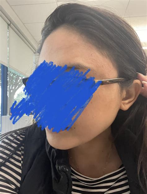 Image result for Seb Derm