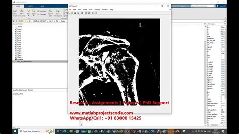 Image result for Thresholding MATLAB