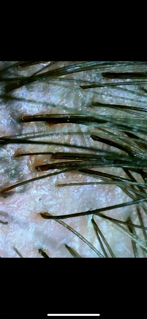 Image result for Seb Derm