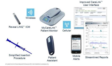 Image result for Loop Recorder Monitor