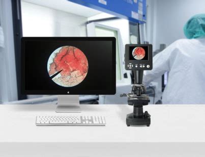 Everything You Need to Know About Digital Microscope Eyepieces ...