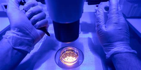 Image result for Embryo Transfer Technology