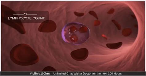 Image result for Lymphs Absolute High Count