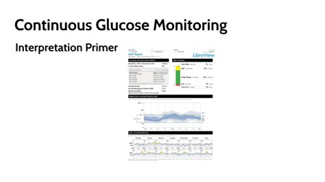 Image result for CGM HD Structured Notes