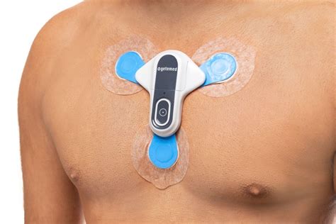 Image result for External Loop Recorder