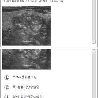 Image result for Computer-Based Test Sample