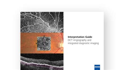 Image result for Oct Interpretation Guide